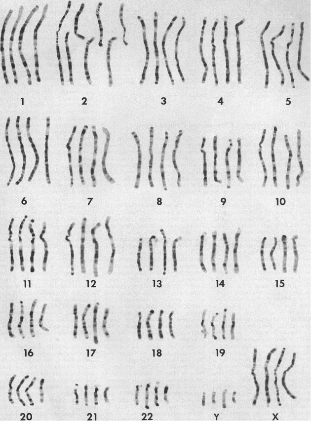 Chromosome 2 Fusion: Evidence Out Of Thin Air? – Creation Questions